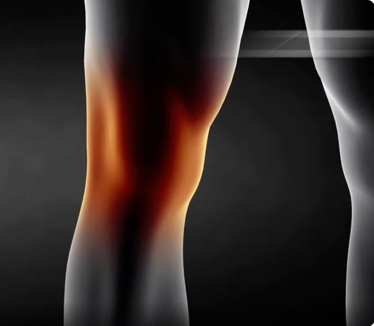 Tib Bar Raises for Knee Pain: Why Strong Shins Protect Your Knees